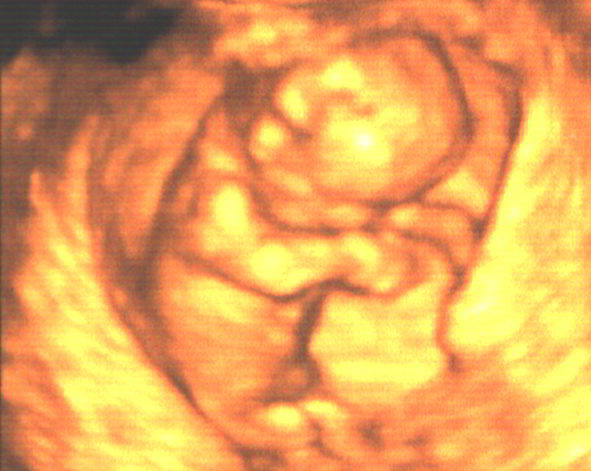 Gestação de 11 a 12 Semanas: fotos da barriga