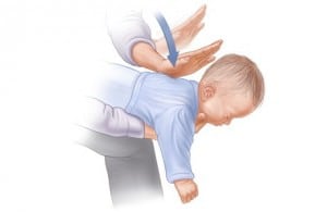 O que fazer em caso de asfixia do bebê?