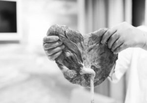 Fases do parto normal: quais são? Passo a passo