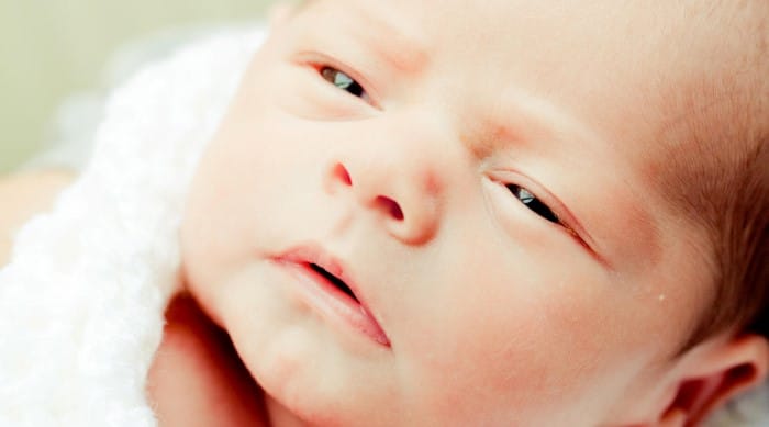 Lacrimejamento excessivo em bebê - O que pode ser?