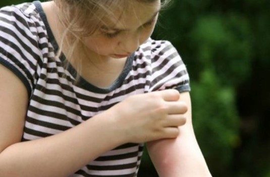 Repelente Exposis para Bebês e Mamães