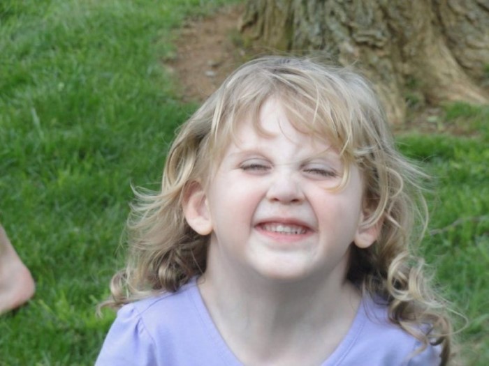 Síndrome de Turner: O que é, Causas e Tratamento