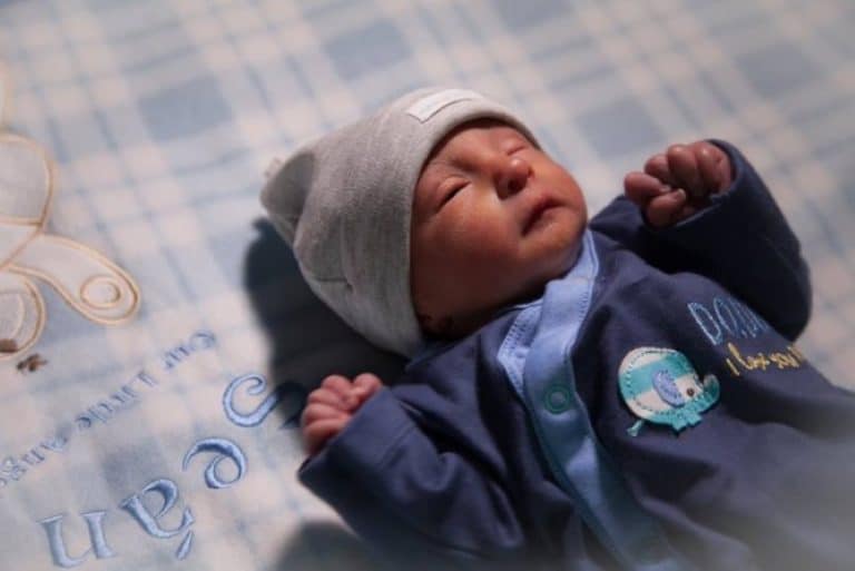 Síndrome de Edwards: Sintomas, causas e tratamentos